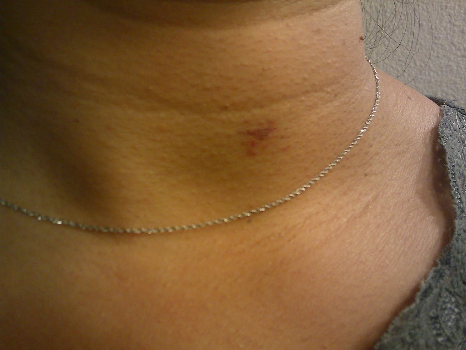 How does my neck look?: How does my neck look? 9/10/10