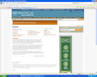 Tashauna Rogers: Credible Vs. Non-Credible Sources for Lupus