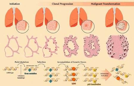 Conceitos Patológicos: NEOPLASIA
