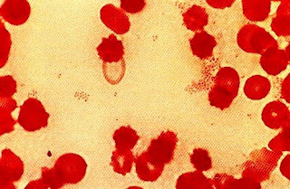 operar equipo de laboratorio clinico 2009: Investigacion (Salmonella ...