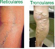 CLINIFE...Centro de Especialidades Medico Quirúrgicos: TRATAMIENTO DE ...