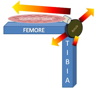 Forza = Motivazione x Allenamento: IperPressione rotulea: Riflessione ...