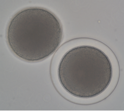 Invertebrate Embryology: Fertilization in a sea urchin and a starfish