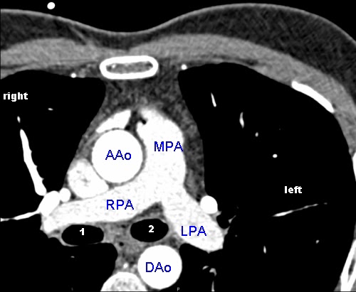 CT2009: CT Protocols Quiz