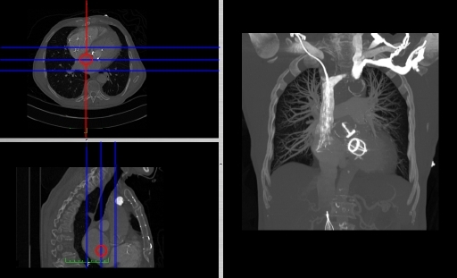 CI-2010: VRT, MIP, & MPR