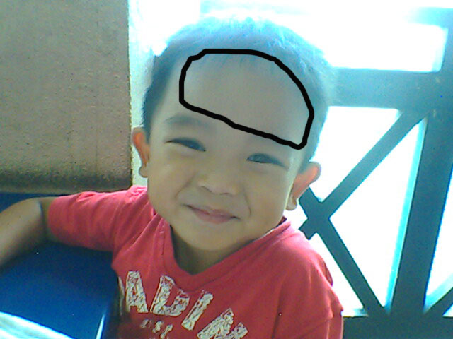Behind This Black Eyes: jendul, jendol, dahi luas.