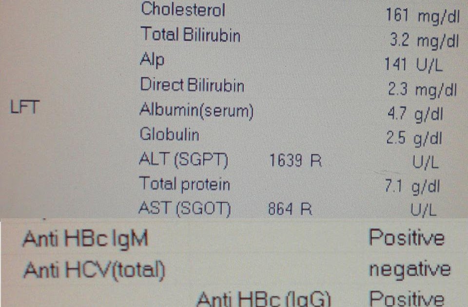 Phimaimedicine: 480. Acute viral hepatitis B profile