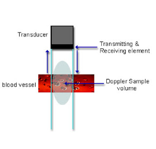 Doppler Physics: DOPPLER ULTRASOUND : PRINCIPLES & PRACTICE