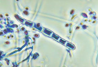 Micologia Biomédica: Dermatófitos: Trichophyton