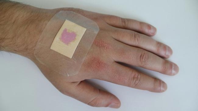 Your Health Partner: Wound Dressing That Changes Colour to Indicate ...