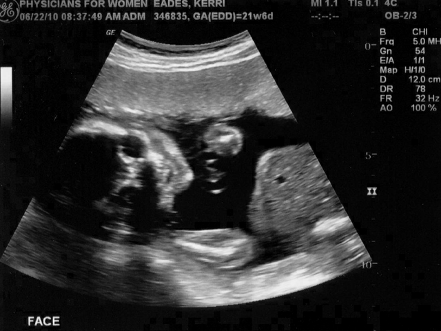 SAWYER KRISTIAN & KATARINA RAE: 22 Weeks Ultrasound- So fun!!