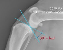 Live Strong, Koda!: TPLO explained with XRAYS