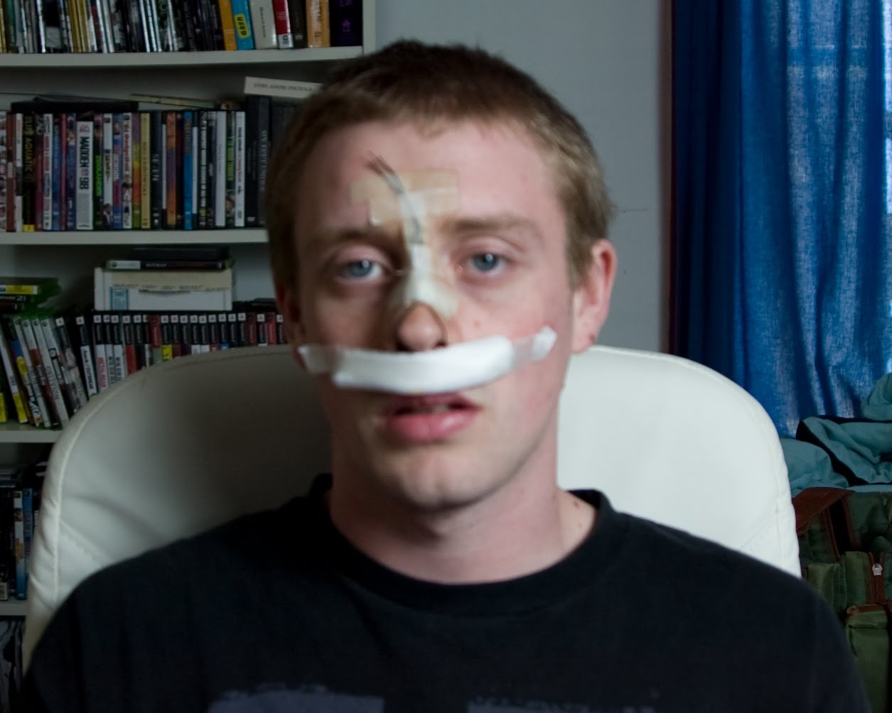 The Luke Dari-blog: Smash Face 2010