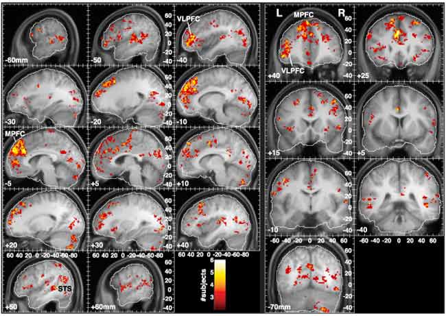 Music and Brain Blog at University of Toronto: Music-Memory Connection ...