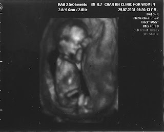 The Bub in the Belly: Scan at 14 weeks