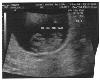 Growing King Family!: 9 weeks 2 days