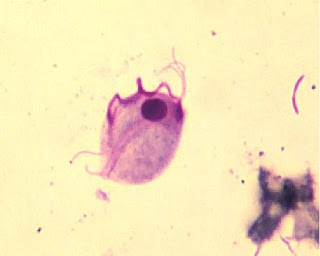 trichomonas
