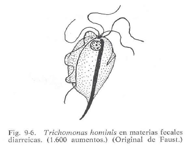 trichomonas