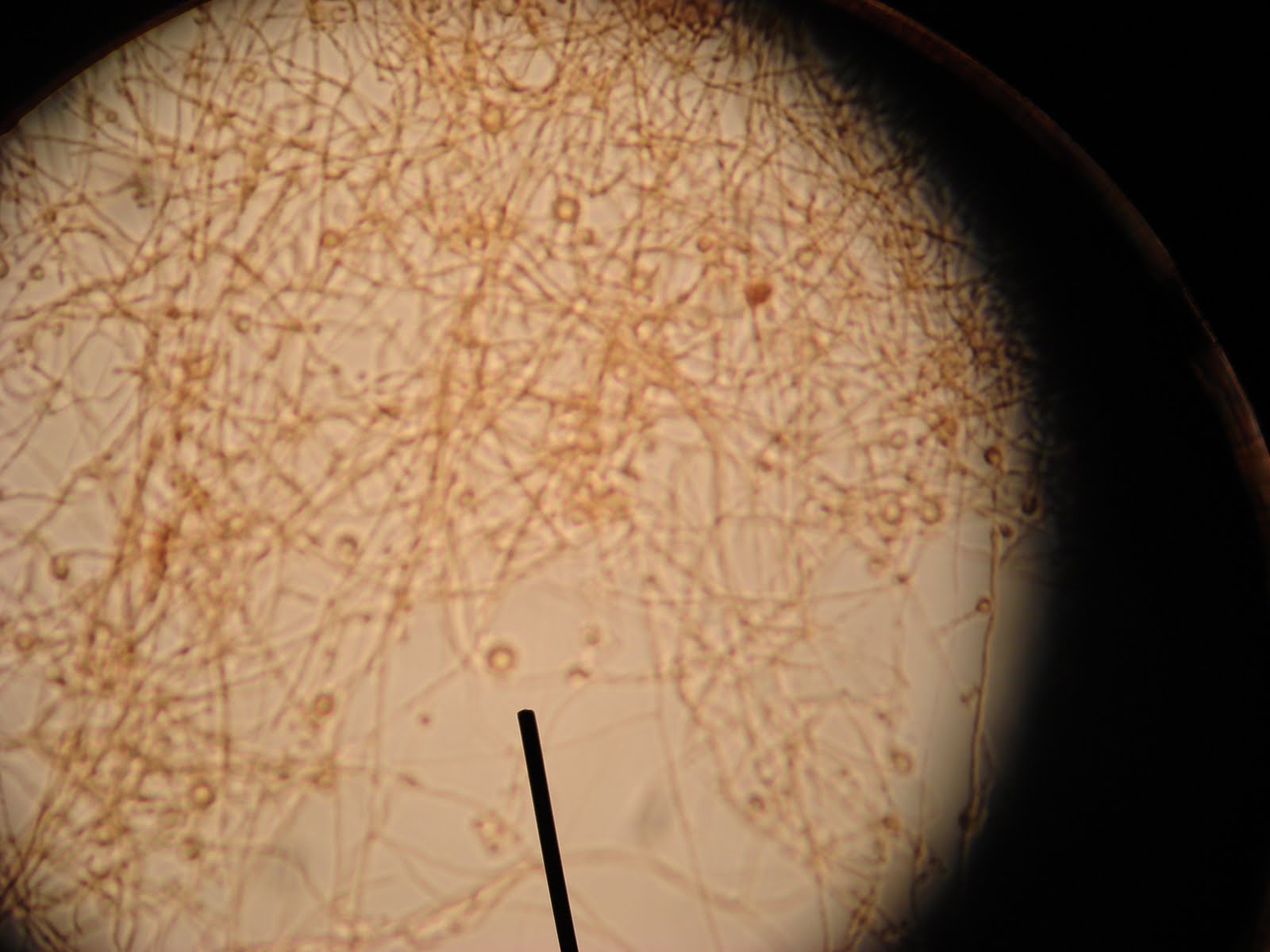 Microbiology: Systemic fungi