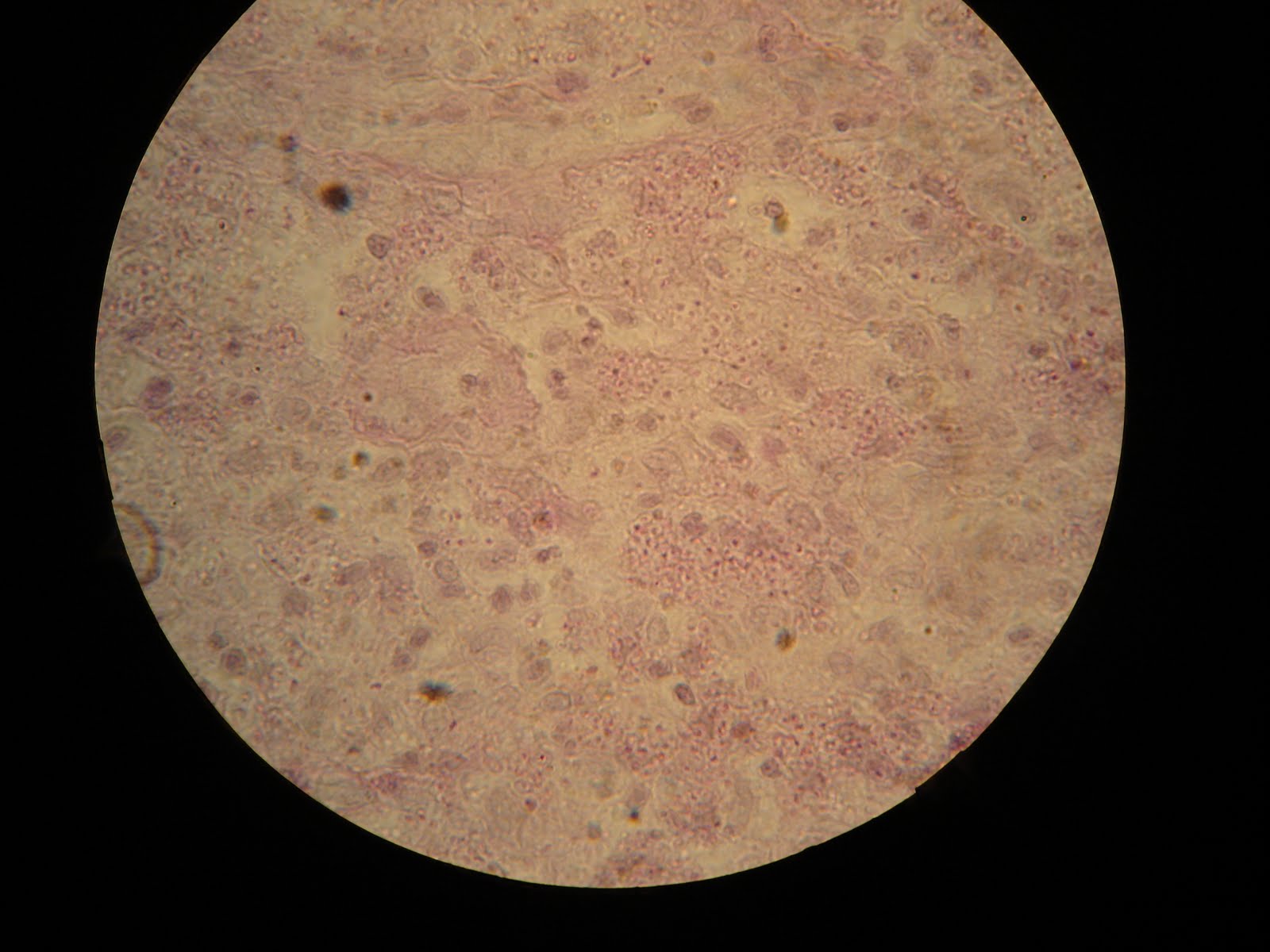 Microbiology: Systemic fungi