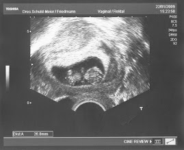 Jessys Schwangerschaft