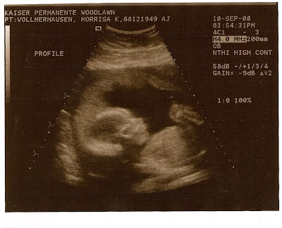 The Making of Baby V: 22 Weeks & Ultrasound Results