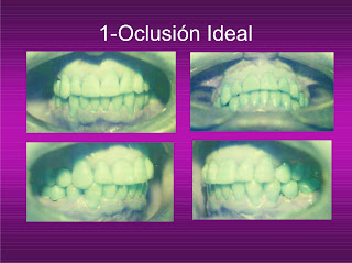 A SU SALUD: 1- Oclusión Ideal