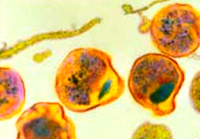 Servicio de Enfermería ::.: ABC de las Infecciones de Transmisión Sexual