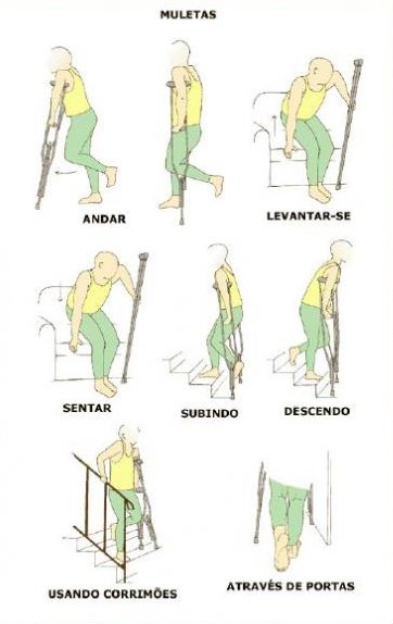 Fisioterapia: A reabilitação da vida: Auxiliares da Marcha - Muletas ...