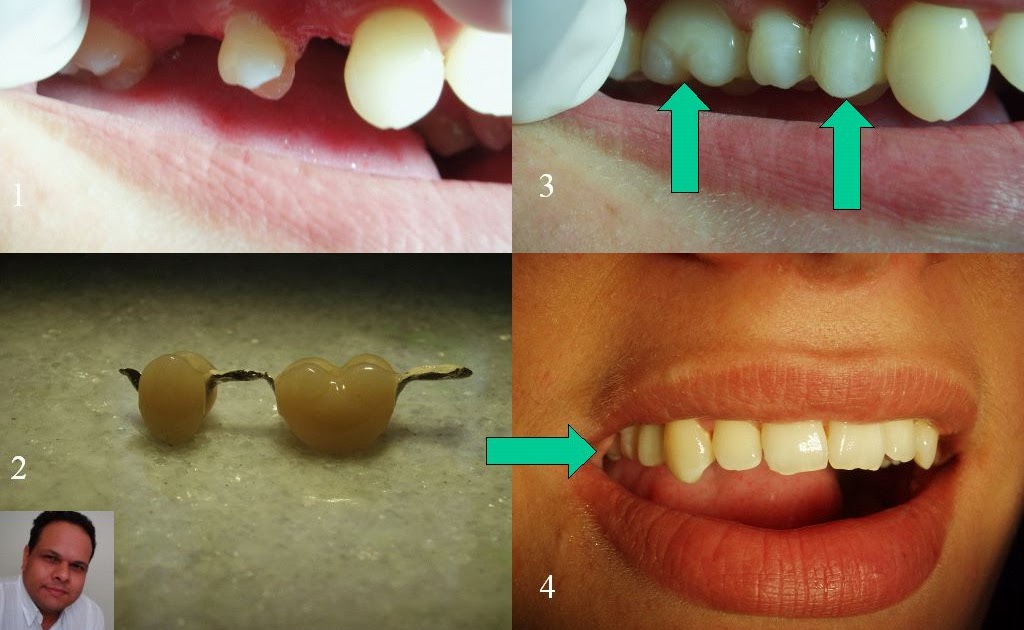 Dr Marlo Vinicios Duarte Lemos - Cirurgião Dentista - Odontologia ...