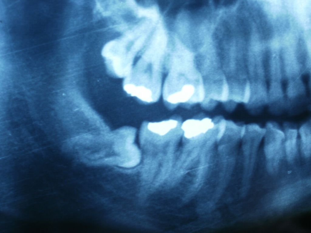 Dr Marlo Vinicios Duarte Lemos - Cirurgião Dentista - Odontologia ...