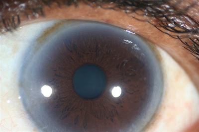 Modern & Multidimensional Iridology: Iridology + Sclerology Analysis
