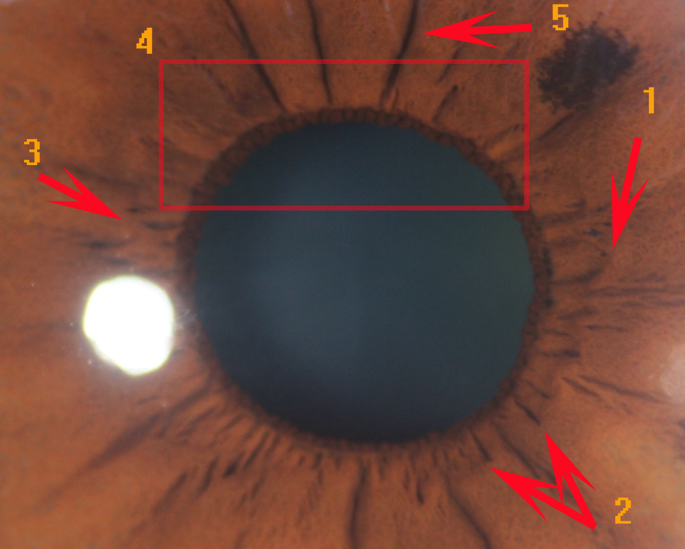Modern & Multidimensional Iridology: Iridology Analysis - 46- Part 1