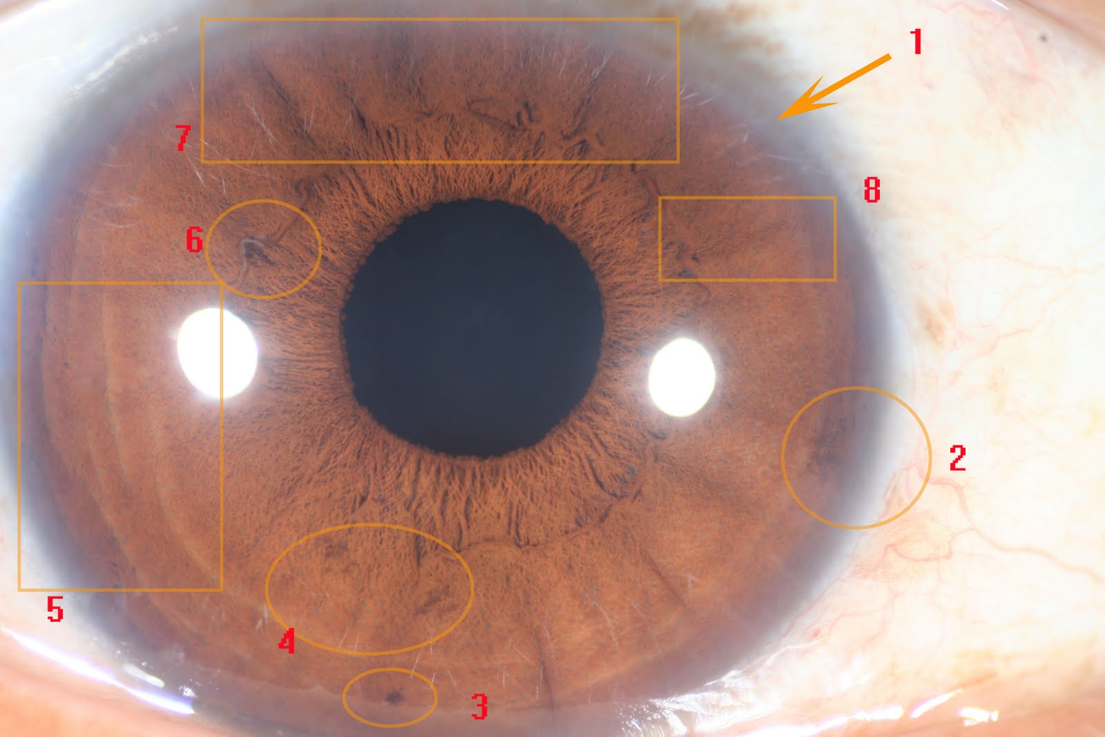 Modern & Multidimensional Iridology: Iridology Analysis - 40