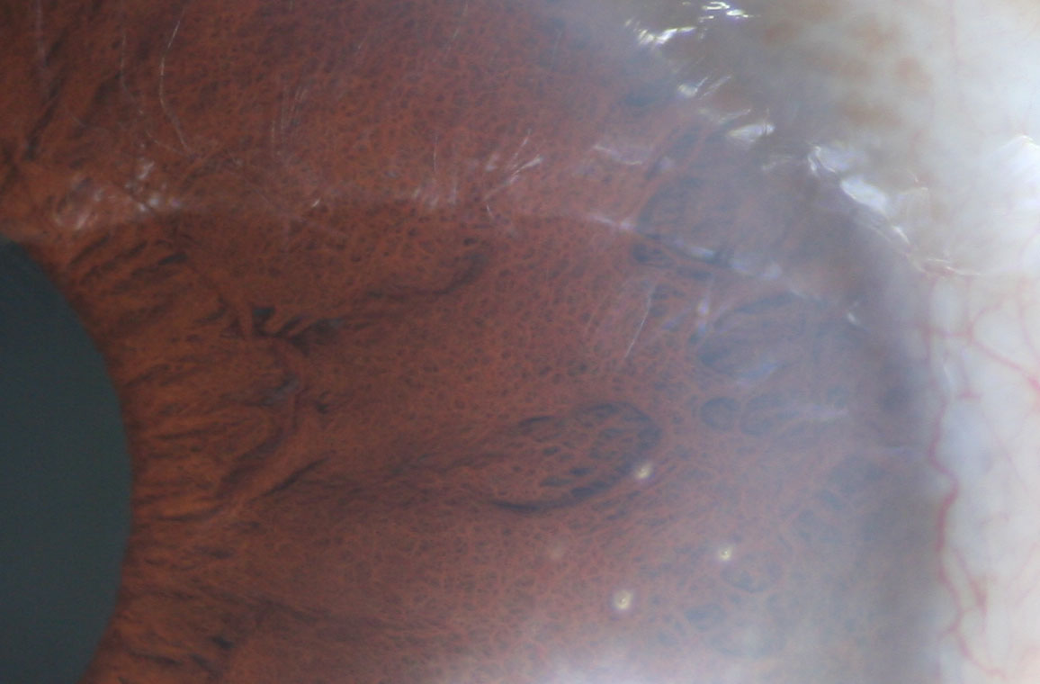 Modern & Multidimensional Iridology: Iridology Analysis - 42