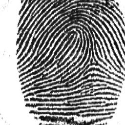 Modern & Multidimensional Iridology: Ulnar & Radial Loop