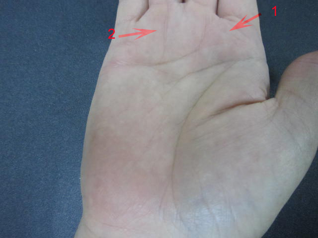 Modern & Multidimensional Iridology: Medical Palmistry Analysis - Digestion