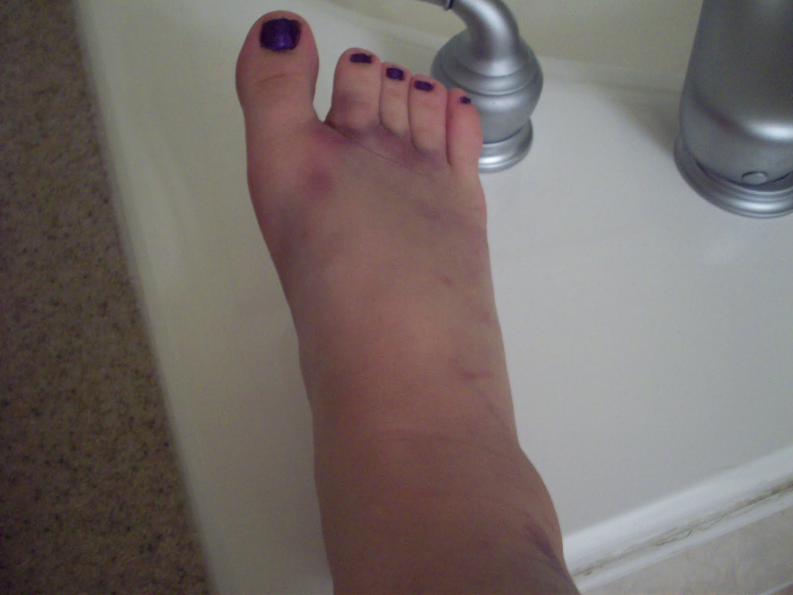 Kali Lana: more ankle grossness!