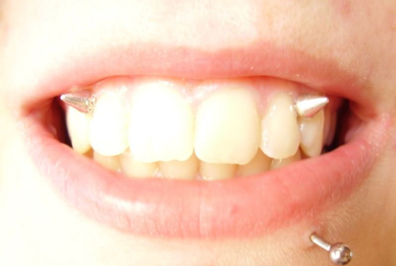 Gum Pierce - BODY PIERCING