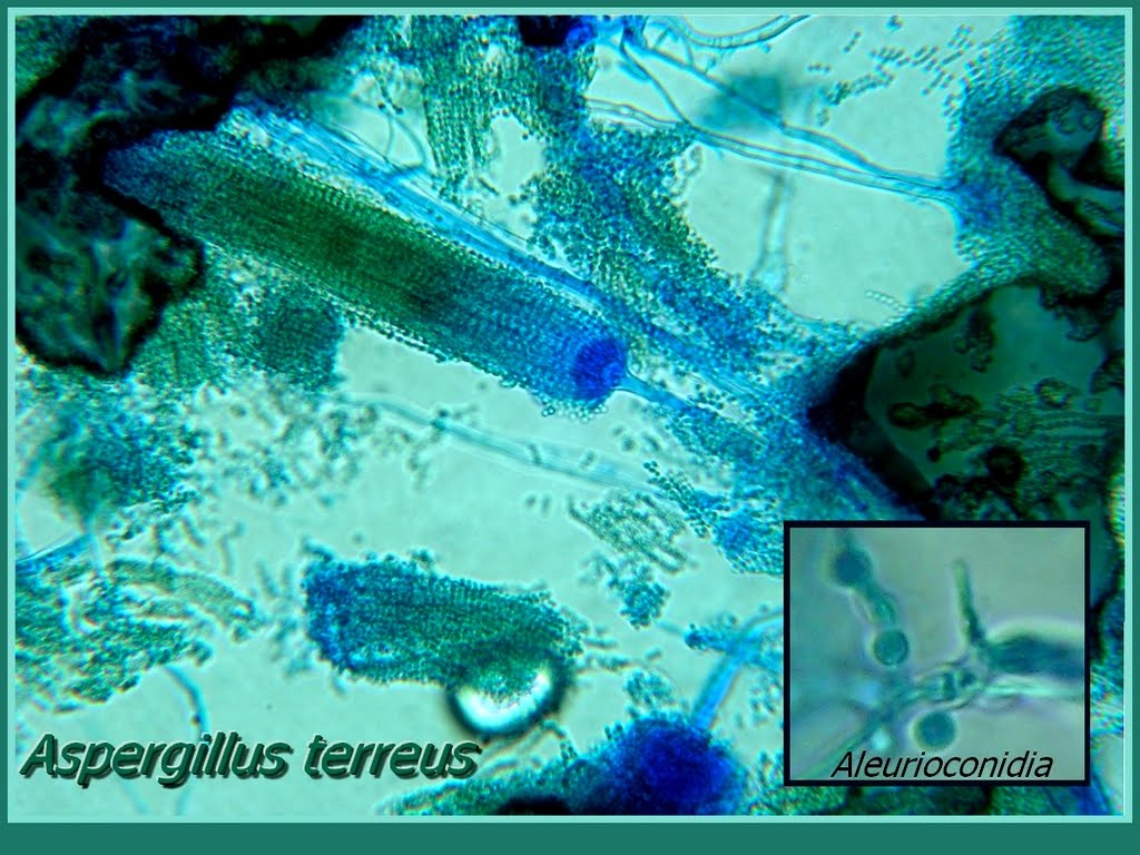 Fun With Microbiology (What's Buggin' You?): Aspergillus terreus