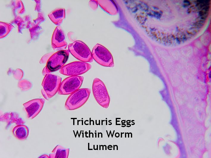 Fun With Microbiology (What's Buggin' You?): Whipworm (Trichuris trichiura)