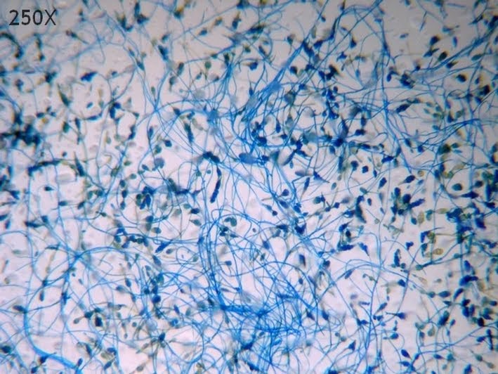 Fun With Microbiology (What's Buggin' You?): Alternaria alternata