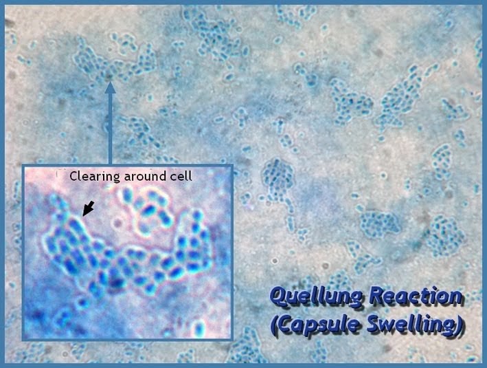 Fun With Microbiology (What's Buggin' You?): Quellung Reaction ...