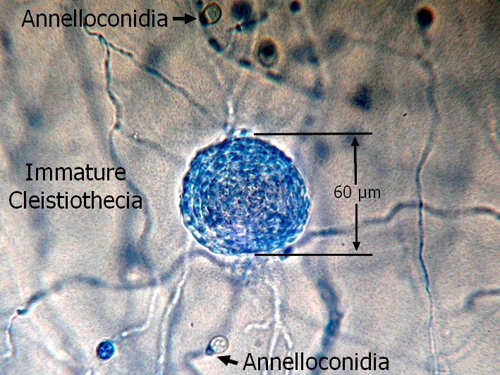 Fun With Microbiology (What's Buggin' You?): Pseudallescheria boydii ...