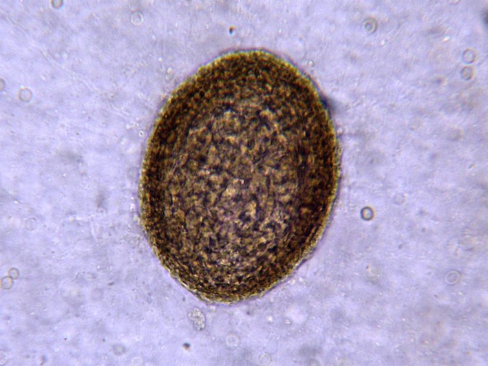 Fun With Microbiology (What's Buggin' You?): Pseudallescheria boydii ...