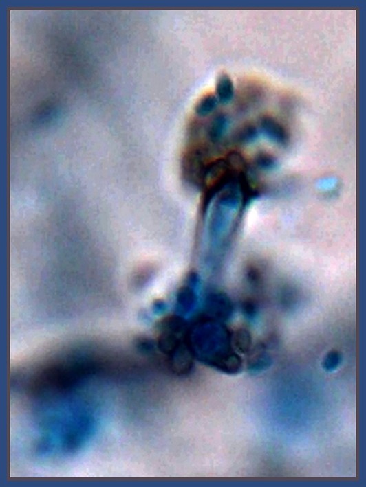 Fun With Microbiology (What's Buggin' You?): Phialophora varrucosa