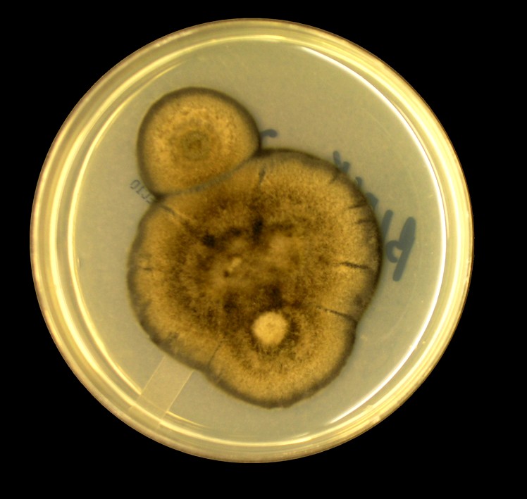 Fun With Microbiology (What's Buggin' You?): Phialophora varrucosa