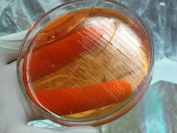 MICROLAB_S-22: METODOS DE SIEMBRA - Estriado