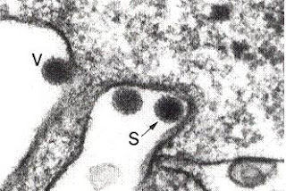 RMC Pharmaceutical Solutions Blog: Can Cache Valley Virus Trash Your ...