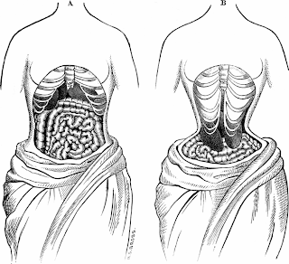 Kaiser's Weird World Weekly: Tightlacing - extreme waists